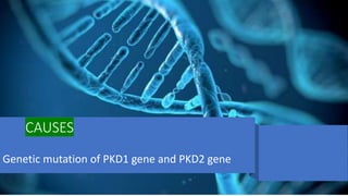 POLYCYSTIC KIDNEY DISEASE FOR NURSING | PPTX
