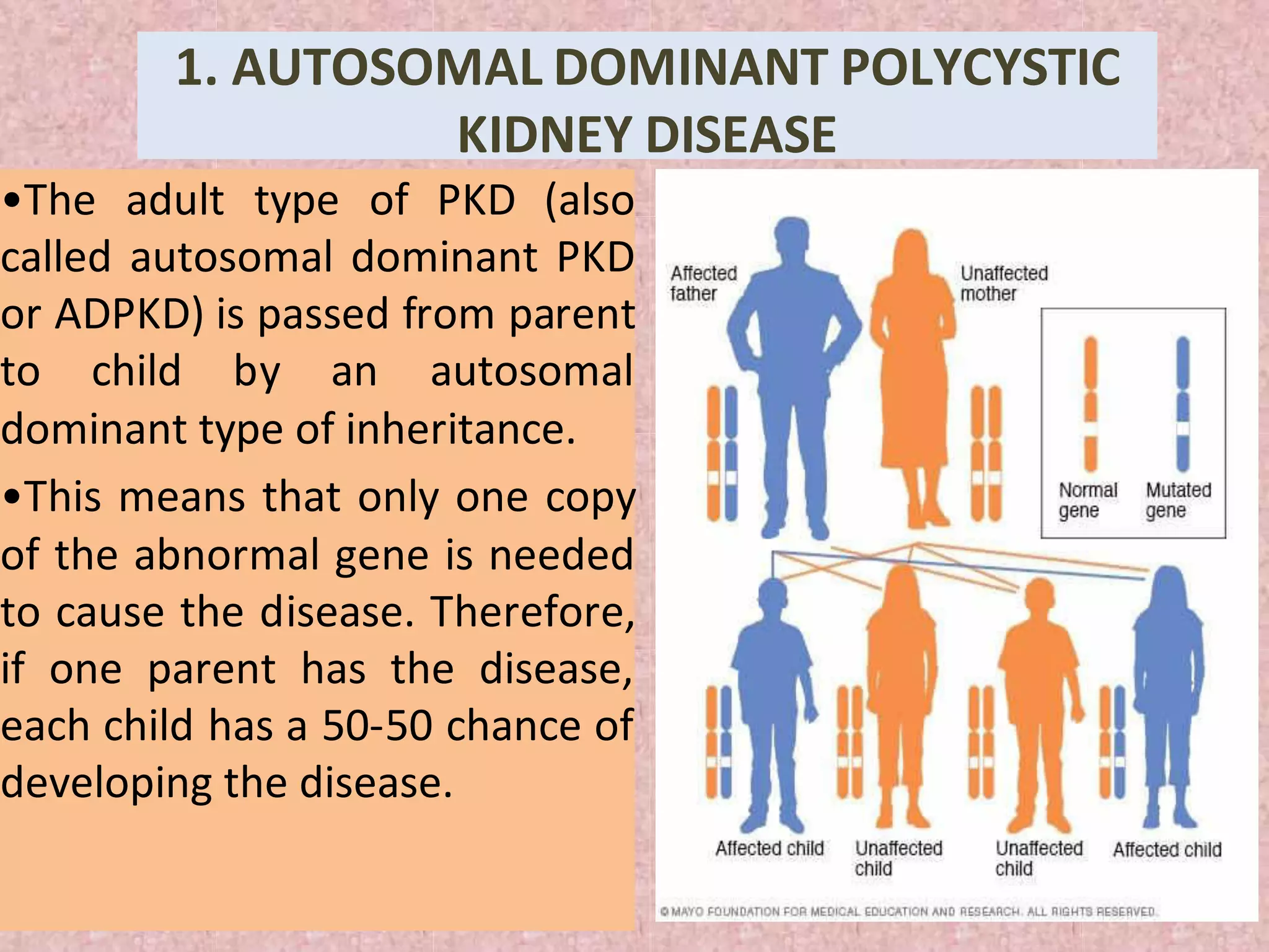 Polycystic kidney disease | PDF