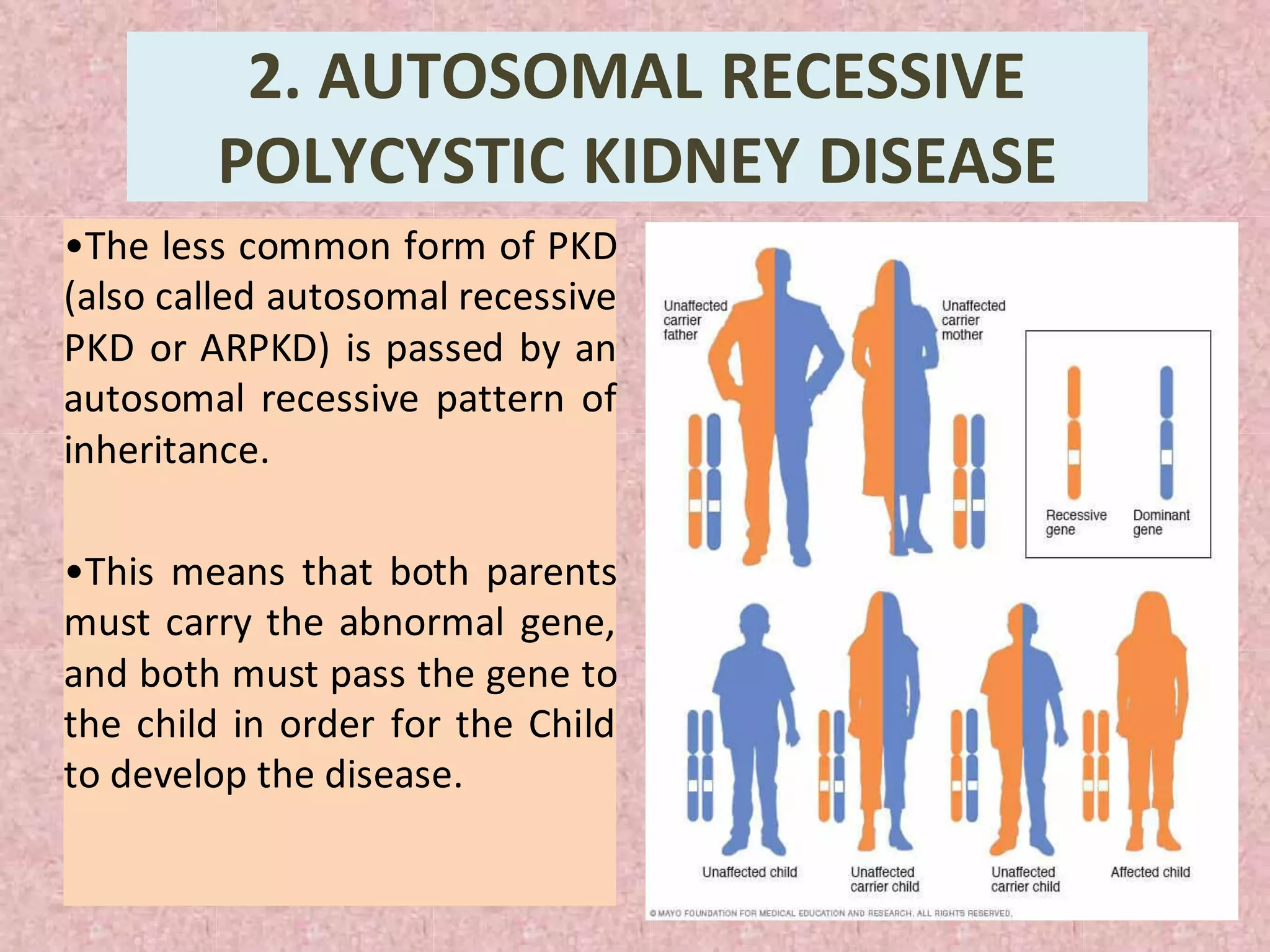 Polycystic kidney disease | PDF