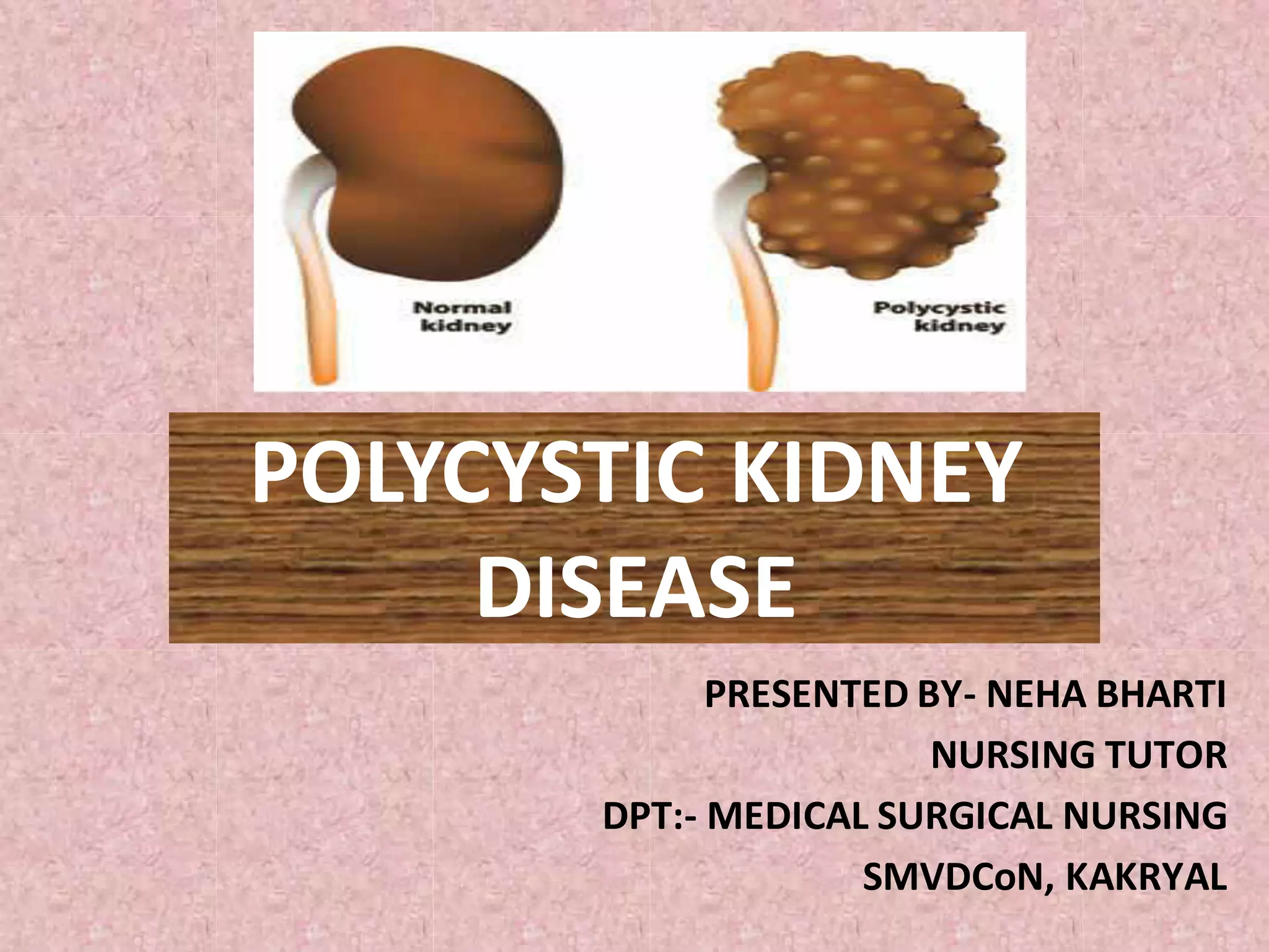 Polycystic kidney disease | PPT