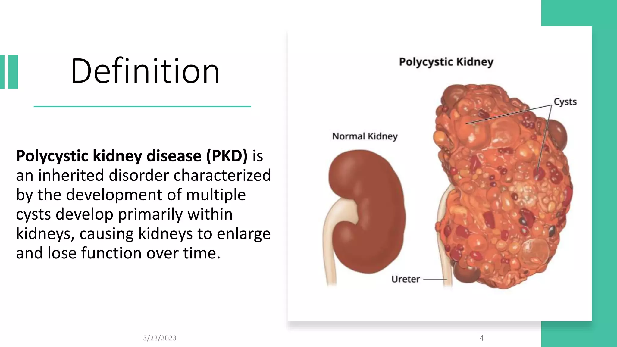 Polycystic Kidney Disease final.pptx