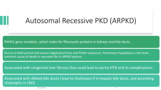 Polycystic Kidney Disease final.pptx