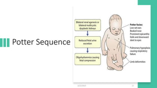 Polycystic Kidney Disease final.pptx