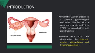 POLYCYSTIC OVARIAN DIEASES(PCOD).pptx