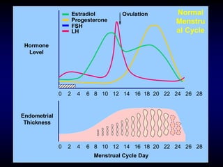 Polycystic ovarian syndrome(1).pdf