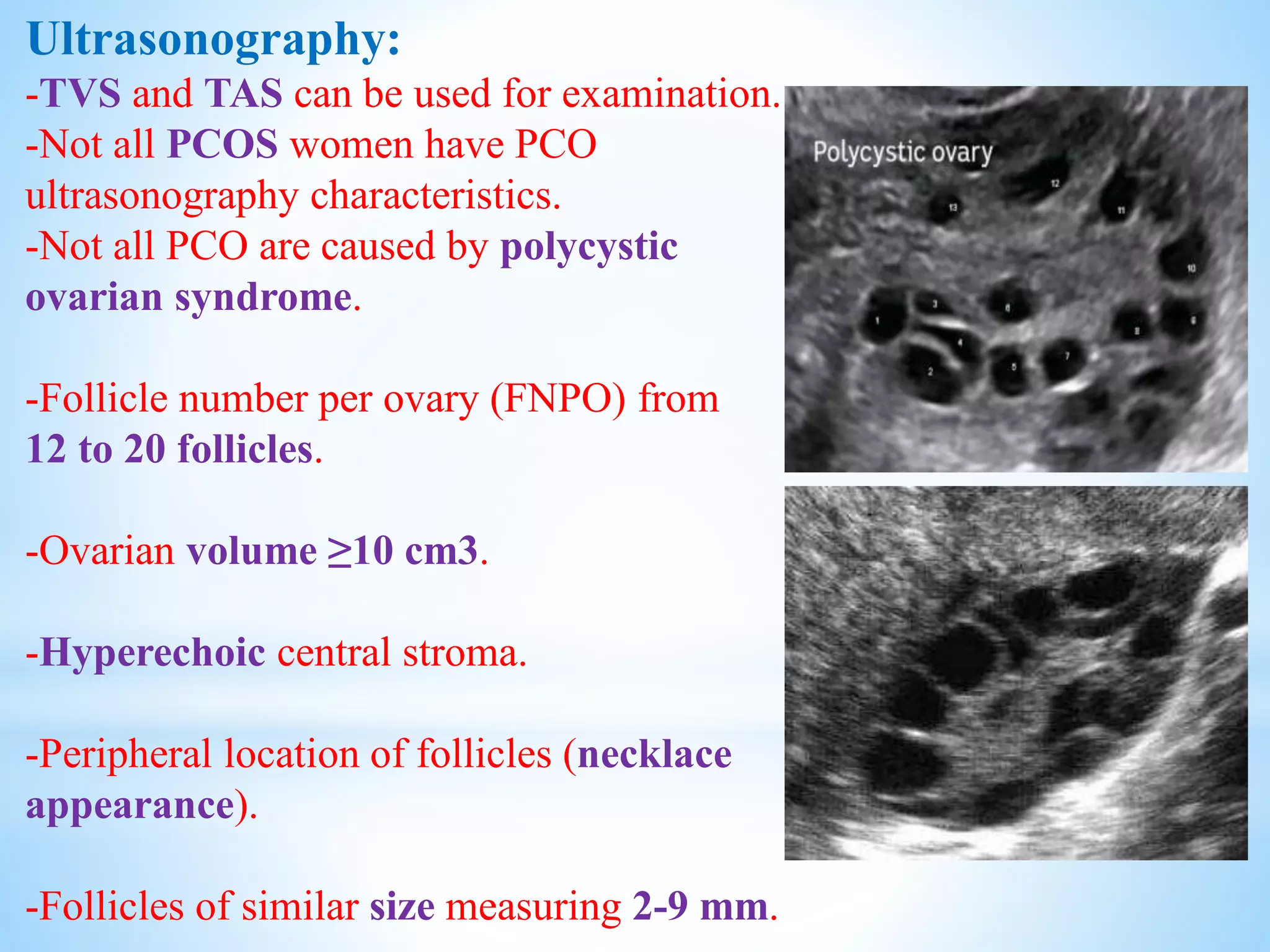 Polycystic ovarian syndrome and role of physical therapy (1) | PDF