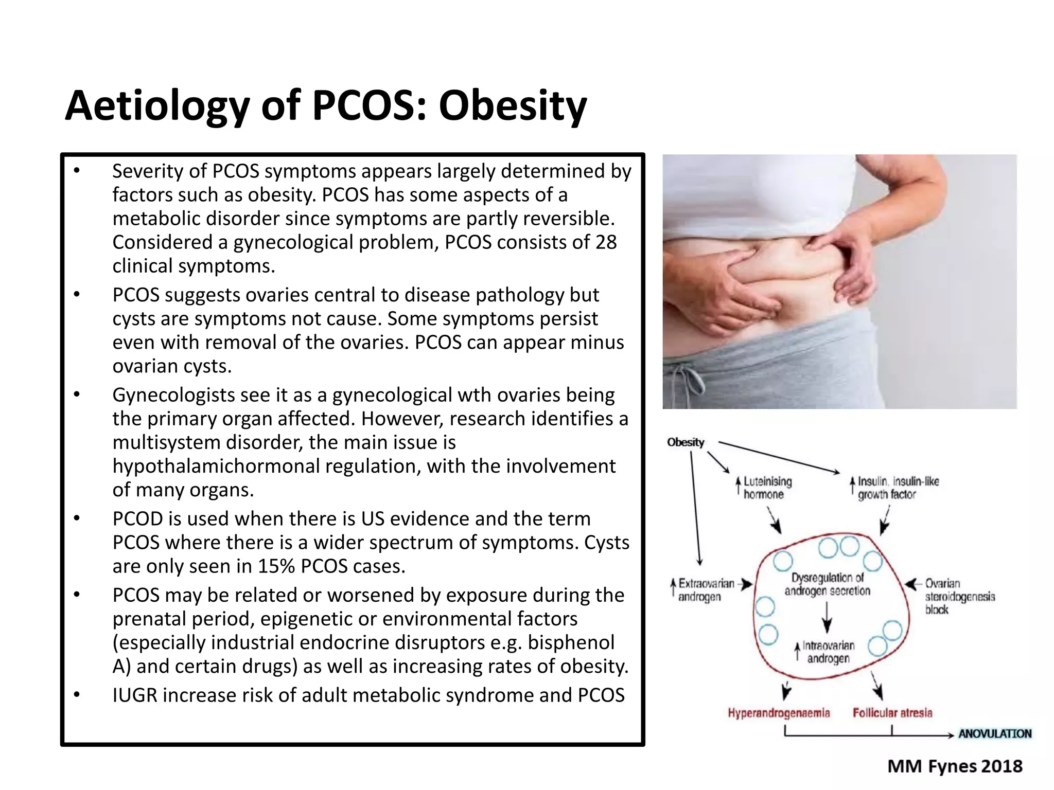 Polycystic Ovarian Syndrome (PCOS) | PDF