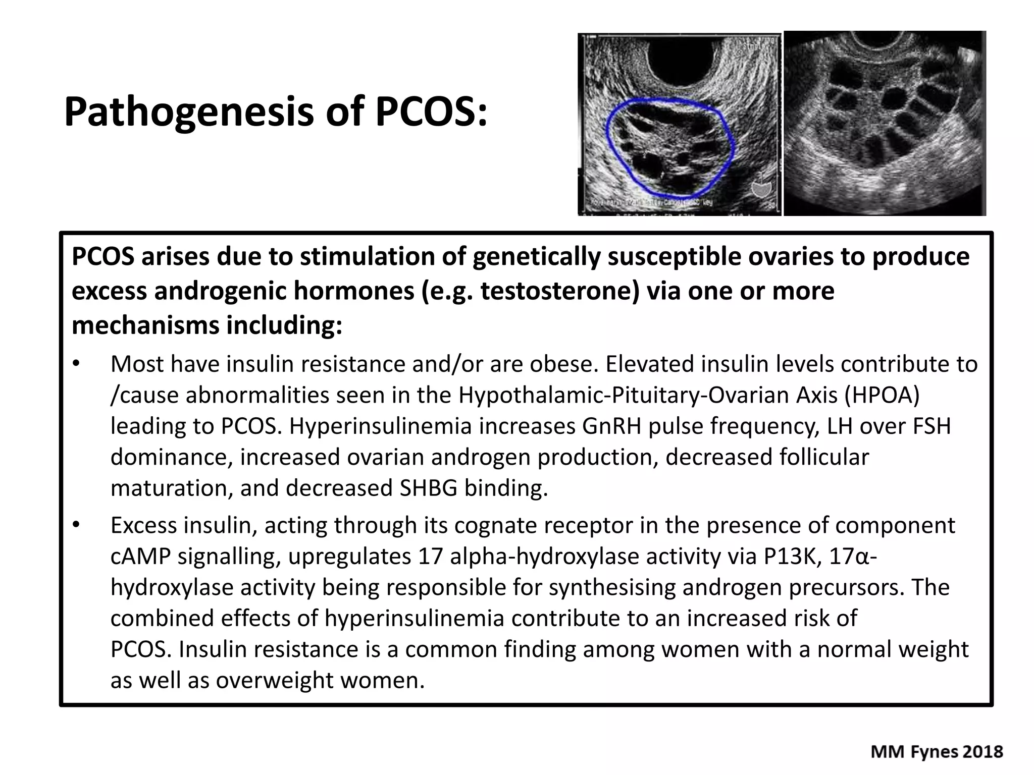 Polycystic Ovarian Syndrome (PCOS) | PDF