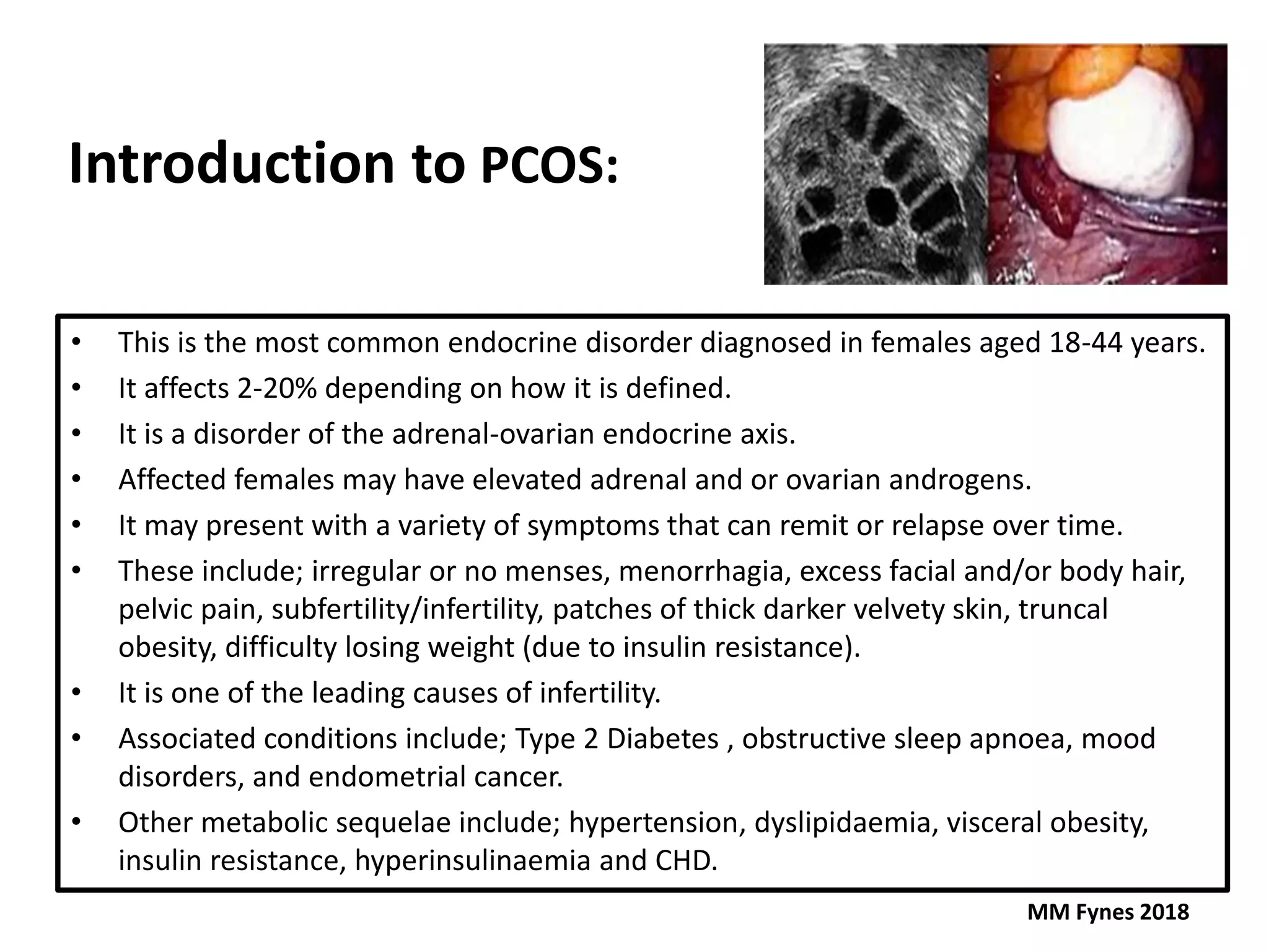 Polycystic Ovarian Syndrome (PCOS) | PDF