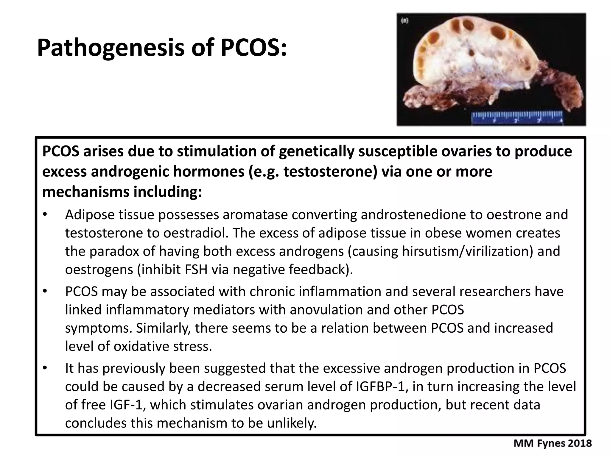 Polycystic Ovarian Syndrome (PCOS) | PDF