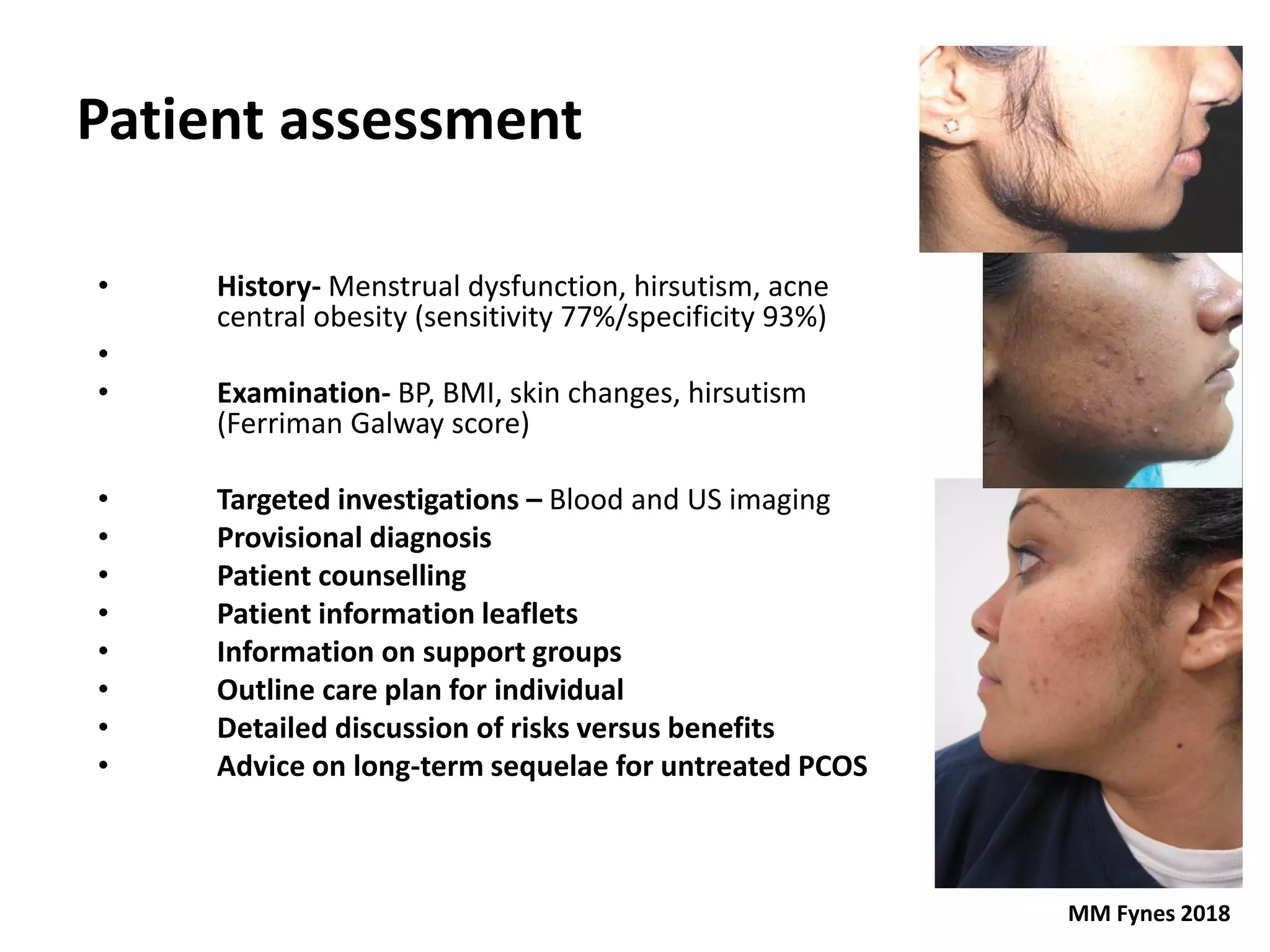 Polycystic Ovarian Syndrome (PCOS) | PDF