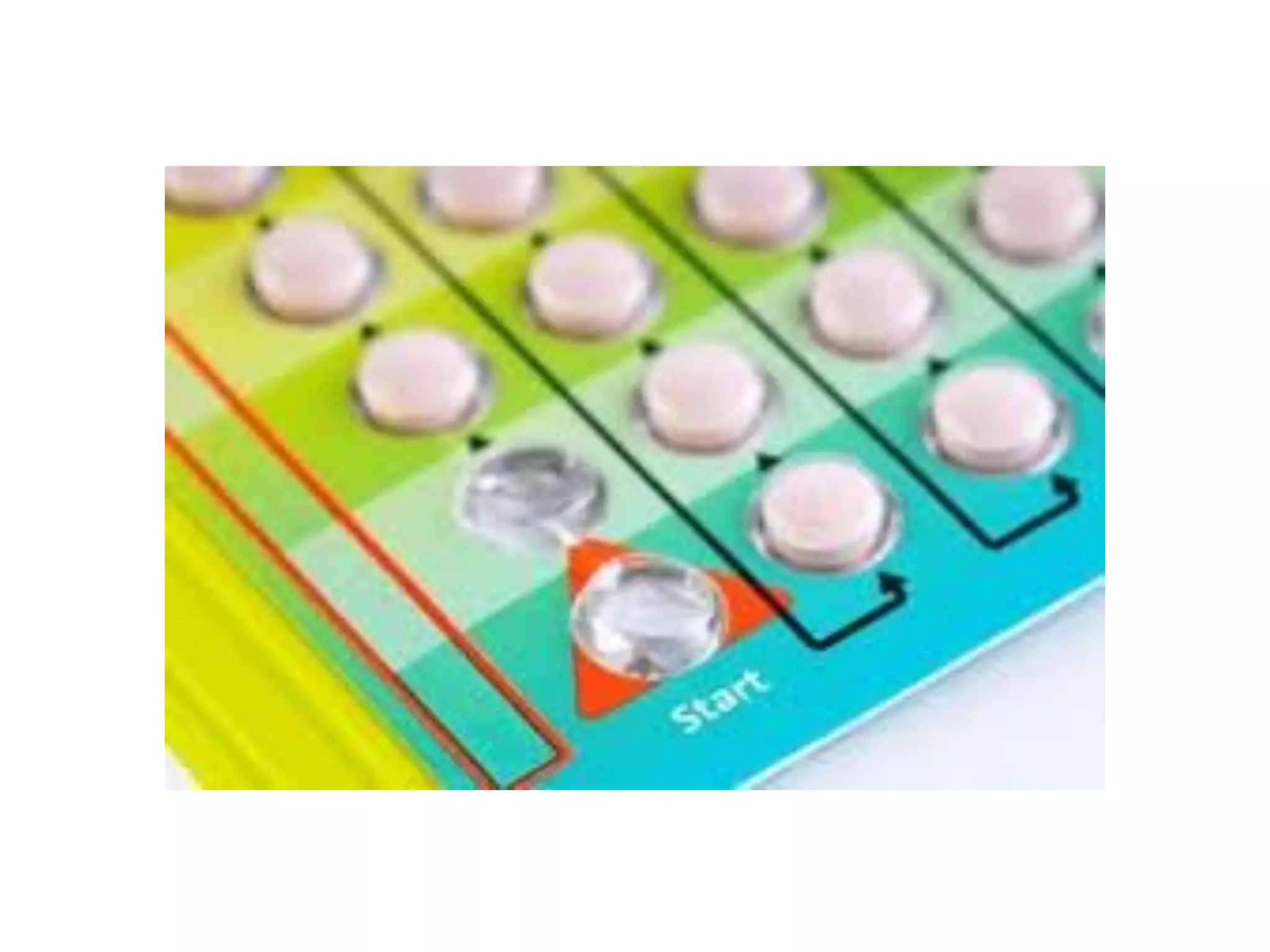 Polycystic Ovarian Syndrome (PCOS) | PDF