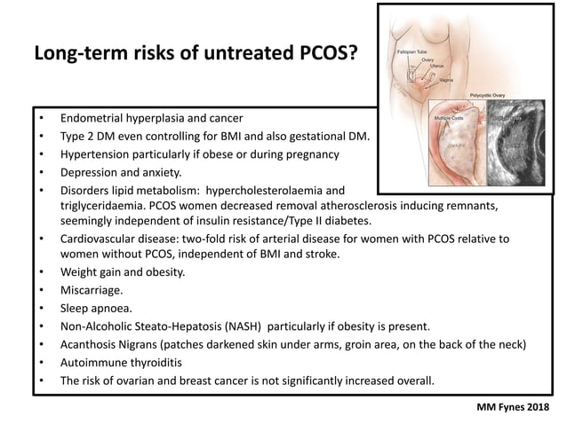 Polycystic Ovarian Syndrome (PCOS) | PDF