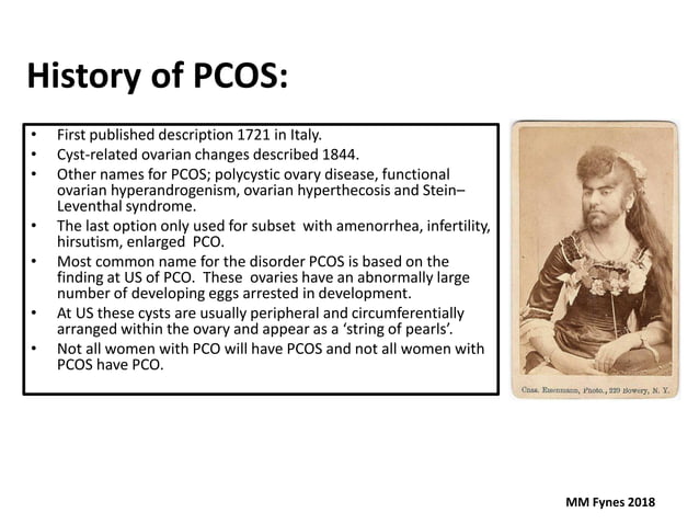 Polycystic Ovarian Syndrome (PCOS) | PDF