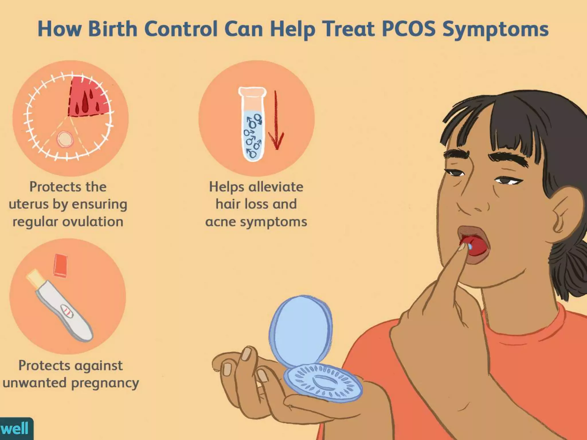 Polycystic Ovarian Syndrome By Roel Tolentino Ppt 9052