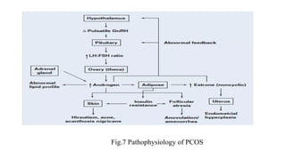 polycystic Ovary Syndrome all details.pptx