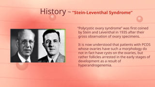 Polycystic Ovary Syndrome according to sa | PPTX