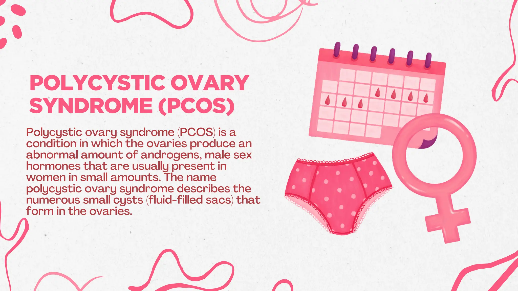 Polycystic Ovary Syndrome (PCOS) ALL.pdf