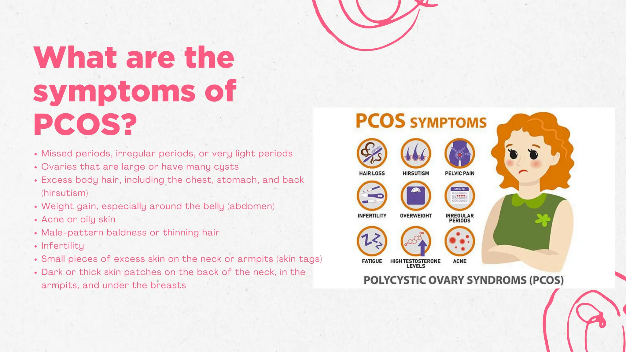 Polycystic Ovary Syndrome (PCOS) ALL.pdf
