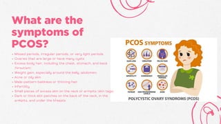 Polycystic Ovary Syndrome (PCOS) ALL.pdf