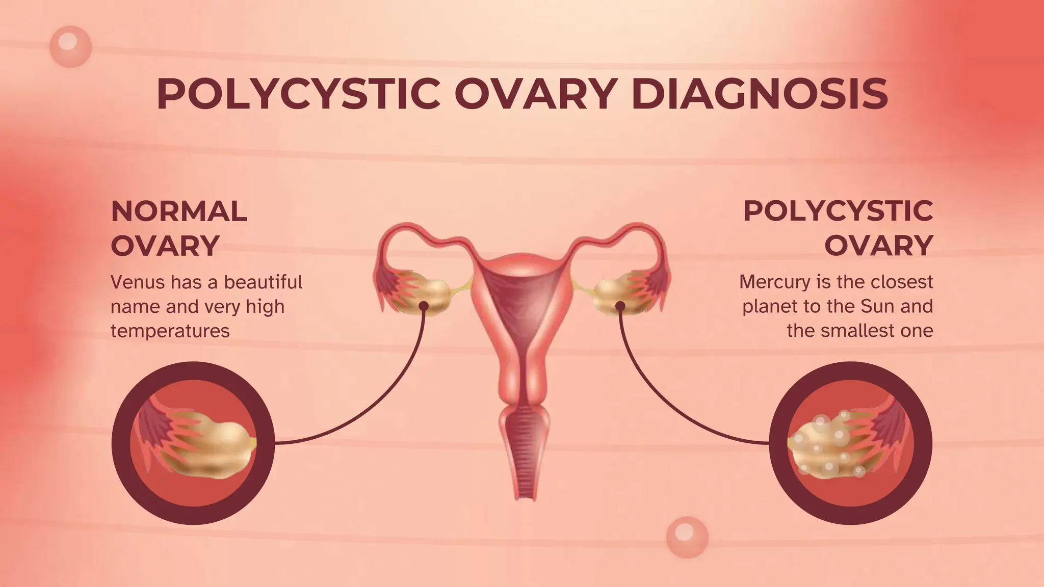 Polycystic Ovary Syndrome (PCOS) by Slidesgo.pptx
