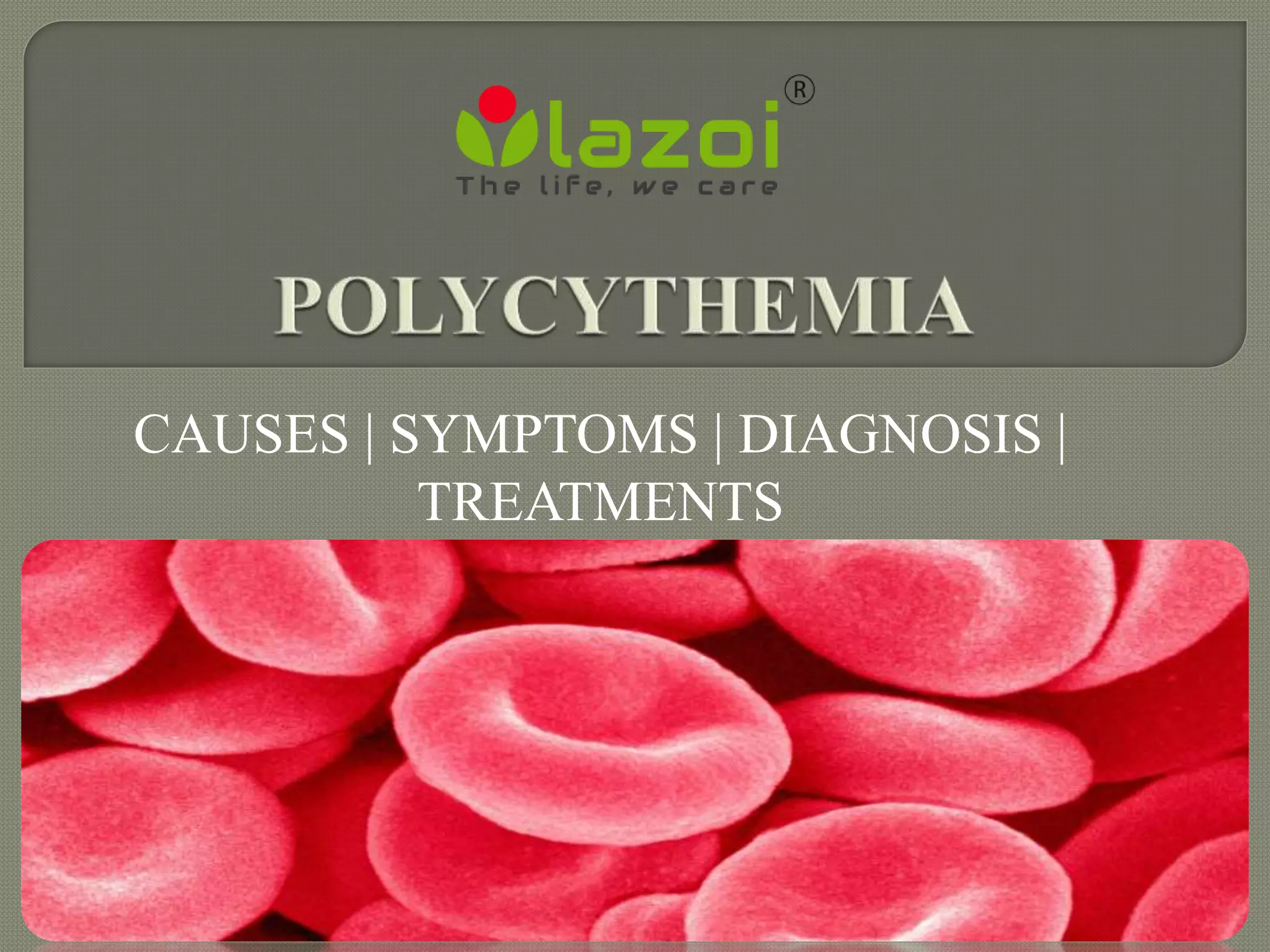 Polycythemia: Causes, symptoms, diagnosis and treatment | PPTX