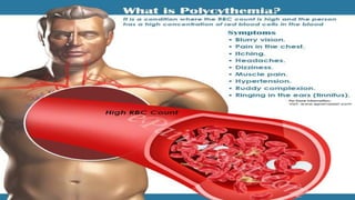 Polycythemia | PDF