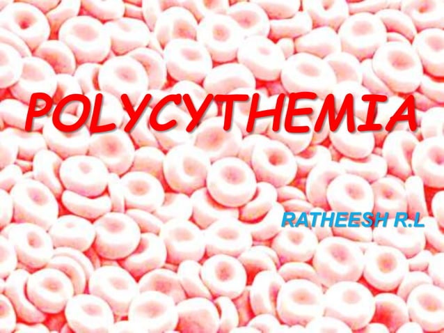 Polycythemia | PPTX