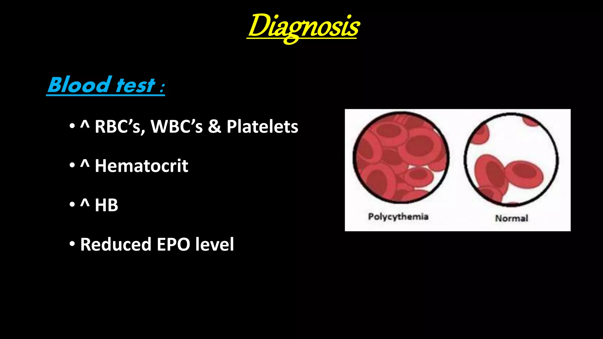 Polycythemia | PPTX