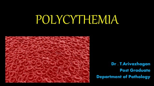 Polycythemia | PPTX