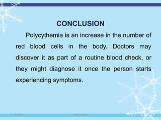 Polycythemia | PPTX