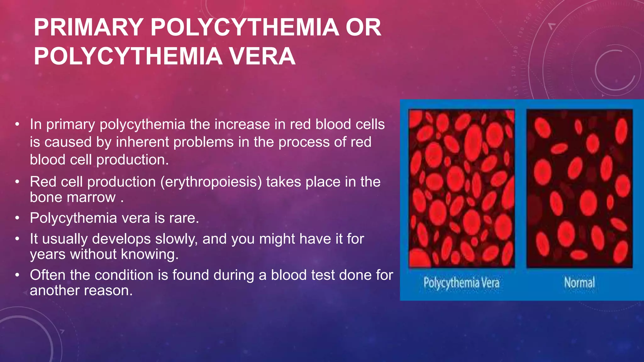 Polycythemia | PPTX