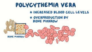 Polycythemia | PPT