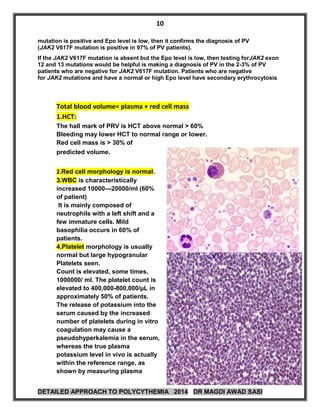 Polycythemia by dr magdi sasi 2014 | PDF