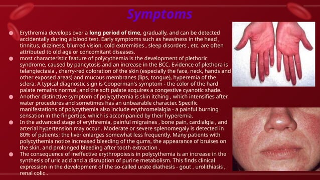 Polycythemia( Erythremia )by Divyansh.pptx