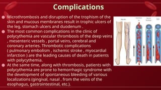 Polycythemia( Erythremia )by Divyansh.pptx