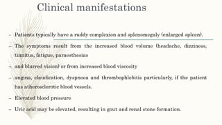 Ruddy Complexion Polycythemia Vera