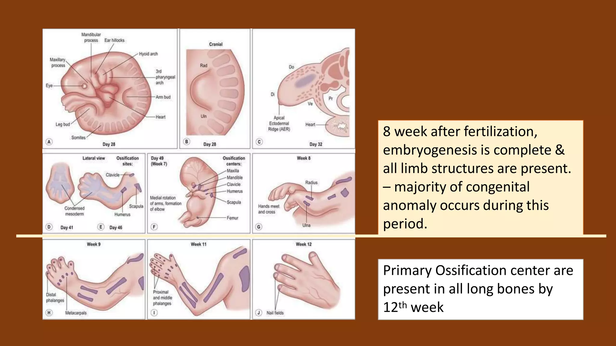 Polydactyly | PPTX