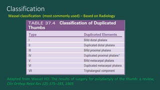 Polydactyly | PPTX