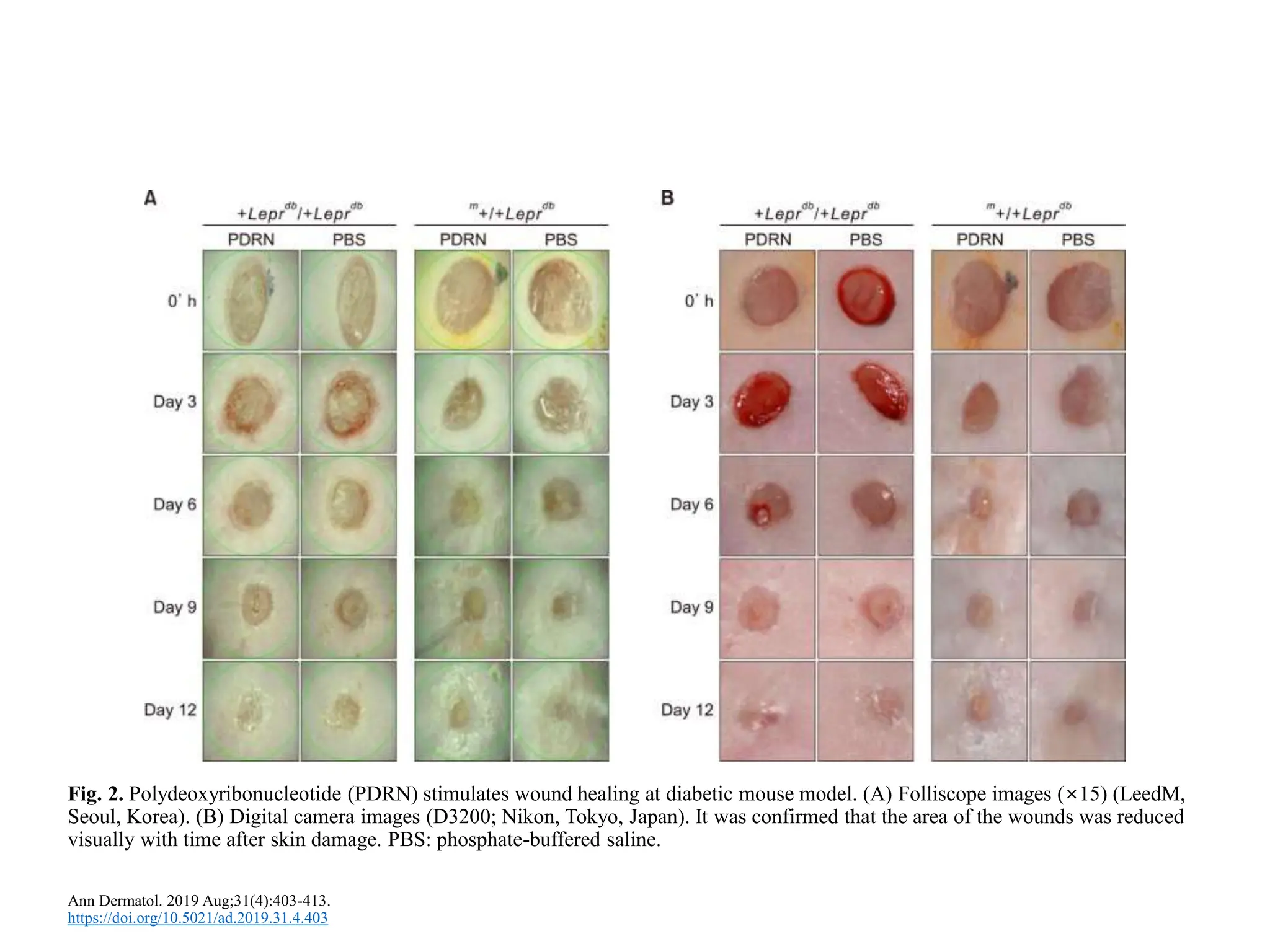 Polydeoxyribonucleotides Improve Diabetic Wound Healing in Mouse Animal ...