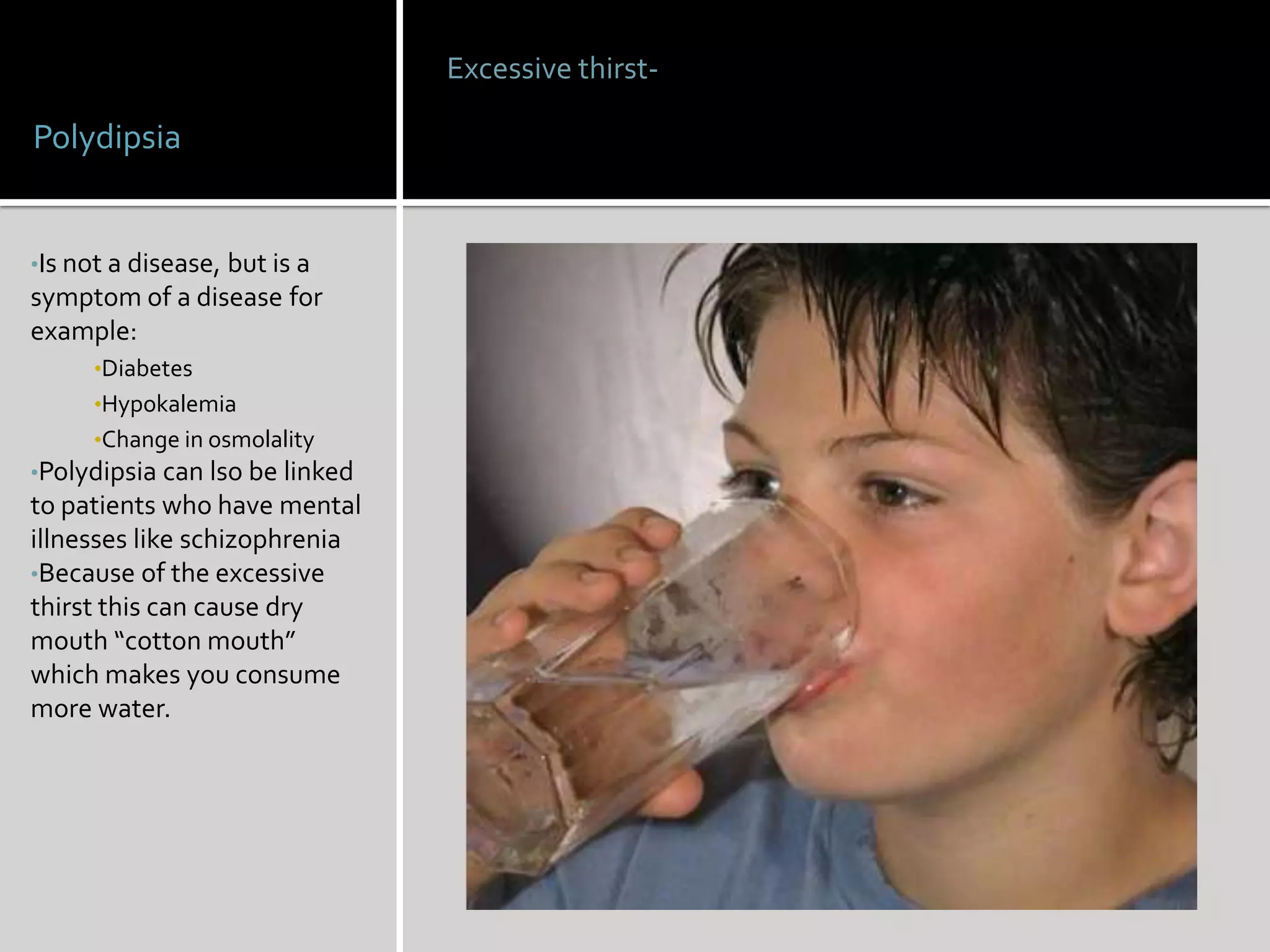 Polydipsia and polyuria | PPTX
