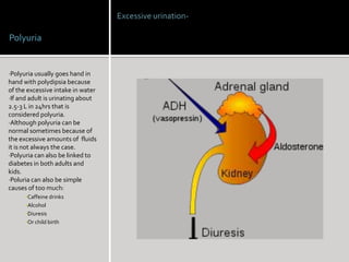 Polydipsia and polyuria | PPTX