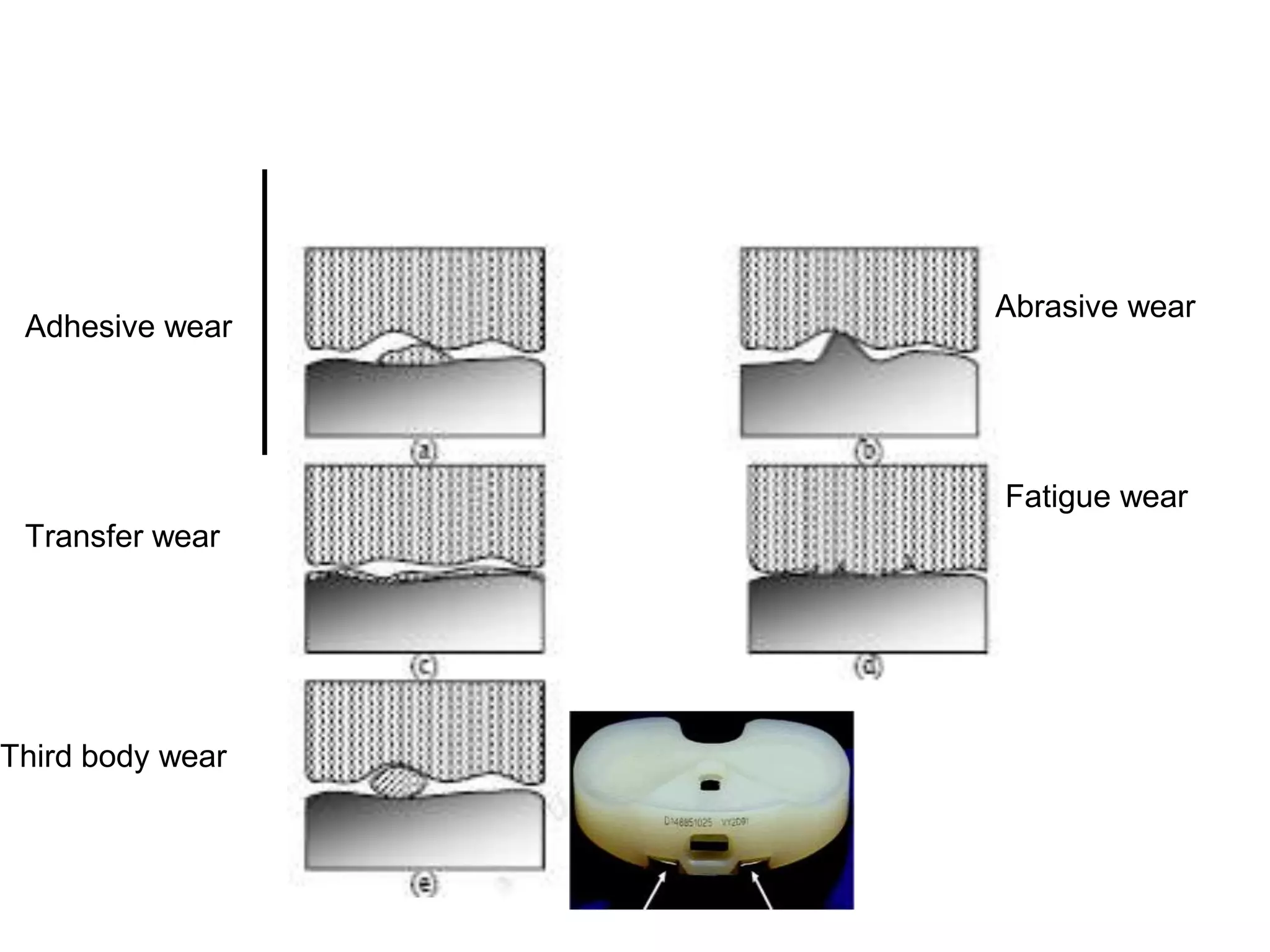 Polyethylene Damage Mechanisms in Total Hip & Total knee Surgeries ,DR ...