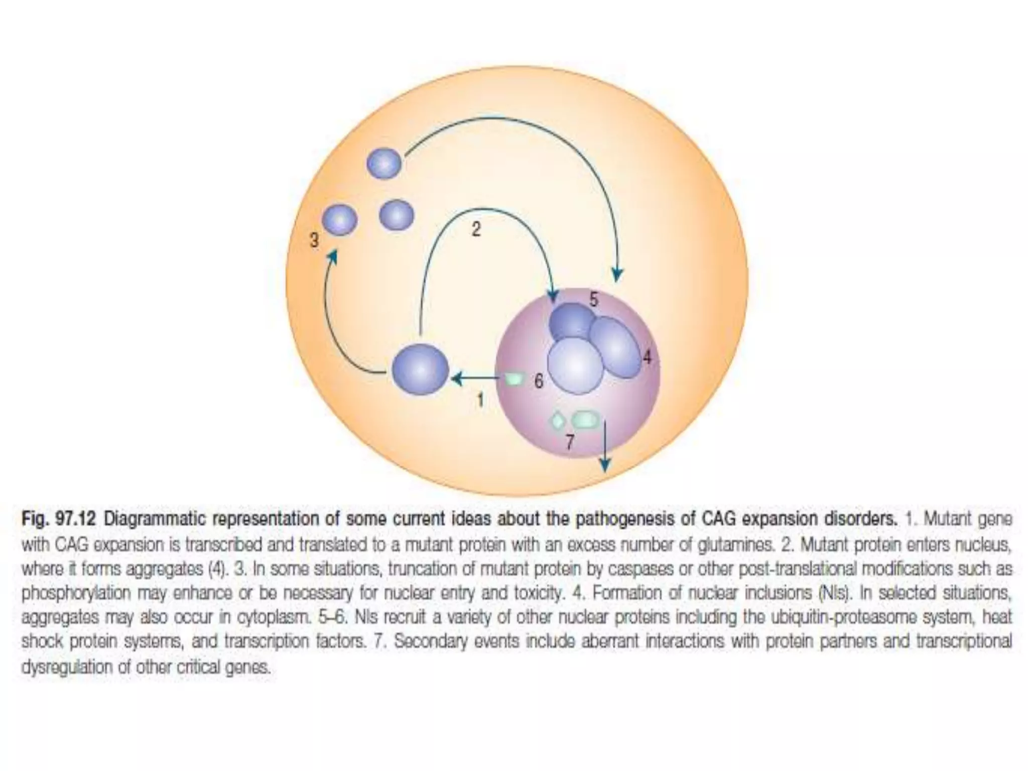 Polyglutaminedisorders | PPT