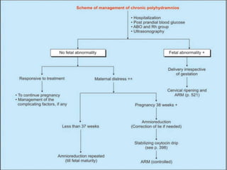 Polyhydramnios | PPTX