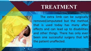 POLYMELIA DISEASE one of the health problem | PPT