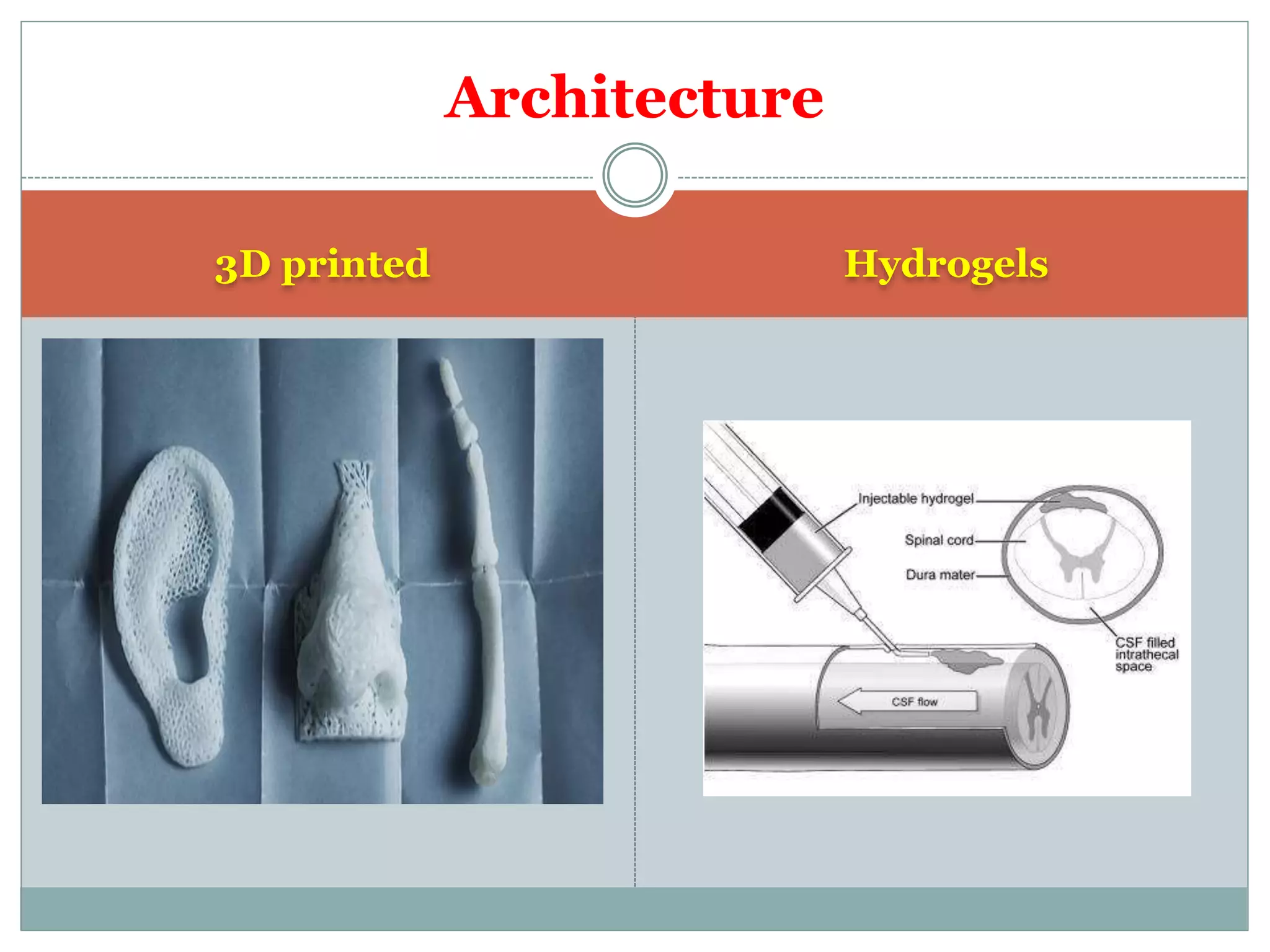 Polymeric and metallic scaffolds for tissue engineering | PPTX