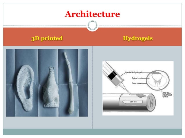 Polymeric and metallic scaffolds for tissue engineering | PPTX
