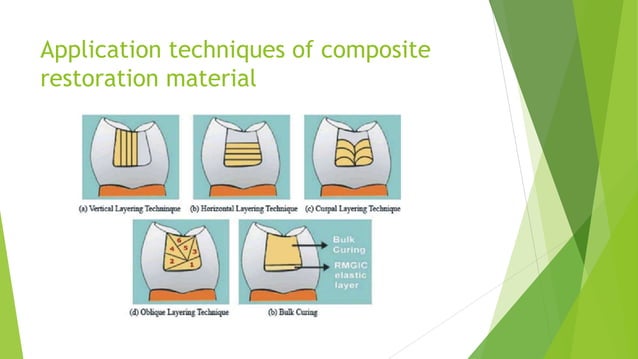 polymerization shrinkage in composite restoration.pptx