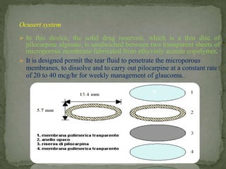 Polymer membrane permeation cdds | PPT